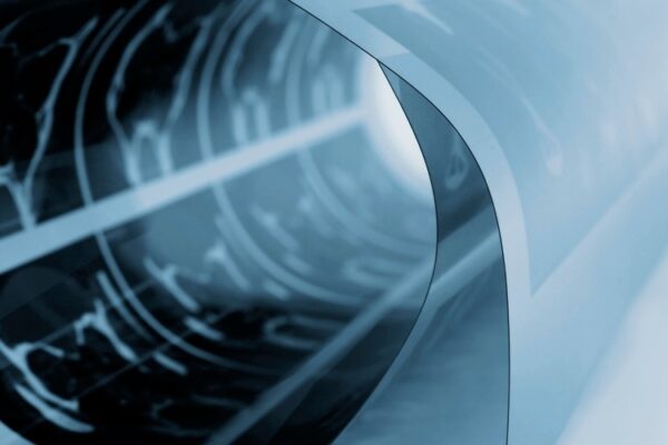 Wat u moet weten over CT-simulatorröntgenbuizen | Radiologie ...