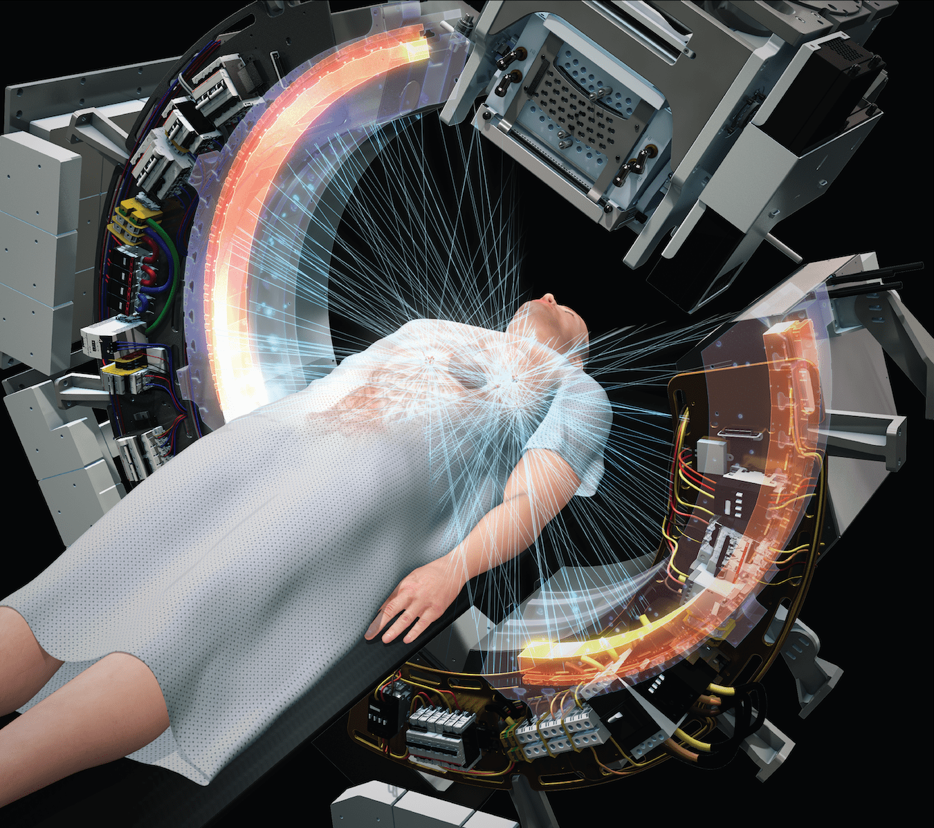 Choosing a Linear Accelerator: The Evolving Landscape in 2025